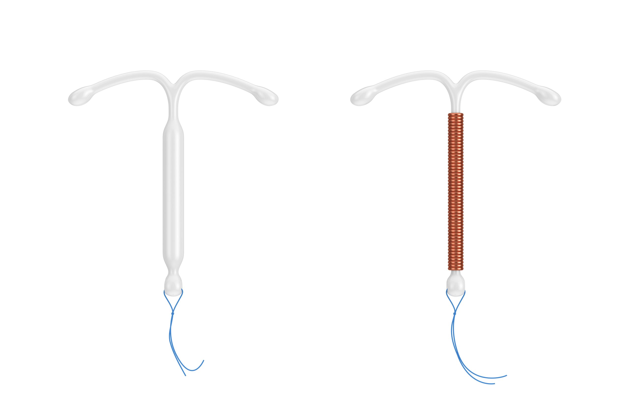 Which coil is right for you – Copper or Hormonal? - Private GP ...